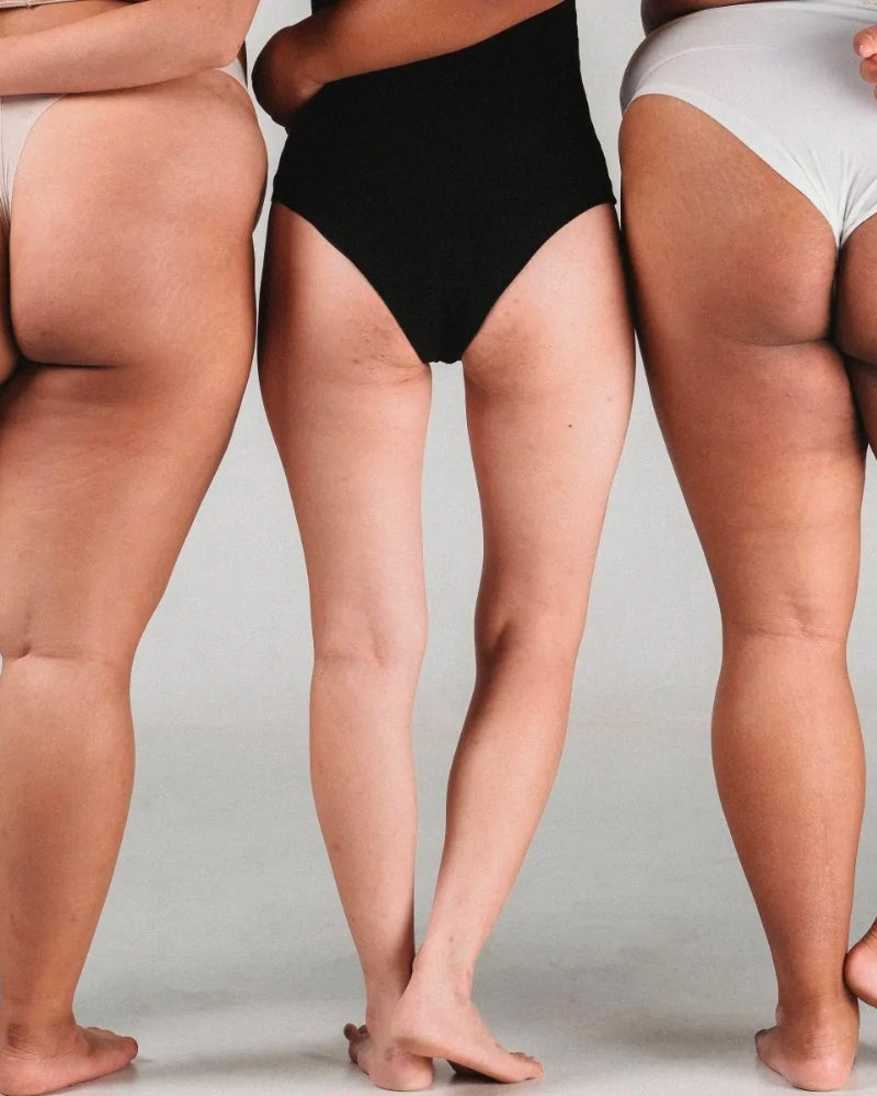is cellulite normal